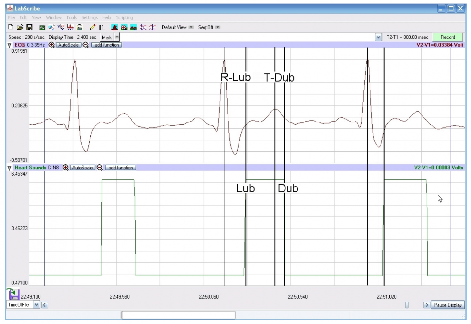 Assessment of Cardiovascular Function – A Mixed Course-Based Research ...